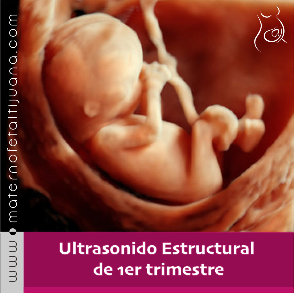 Ultrasonido estructural de 1er. trimestre – Materno Fetal Tijuana